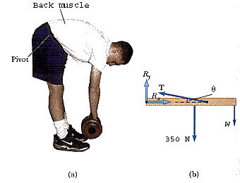 Solved: A Person Bending Forward To Lift A Load "with His ... | Chegg.com