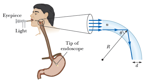 Solved: Endoscopes Are Medical Instruments Used To Examine... | Chegg.com